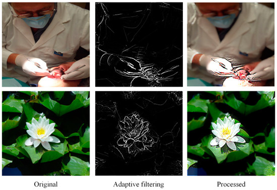 A Visual Enhancement Network with Feature Fusion for Image Aesthetic ...