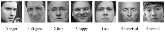 A Multi-View Face Expression Recognition Method Based on DenseNet and GAN