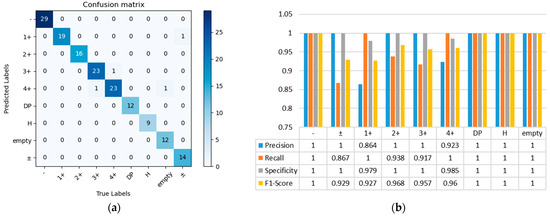 Electronics | Free Full-Text | Blood Group Interpretation Algorithm ...