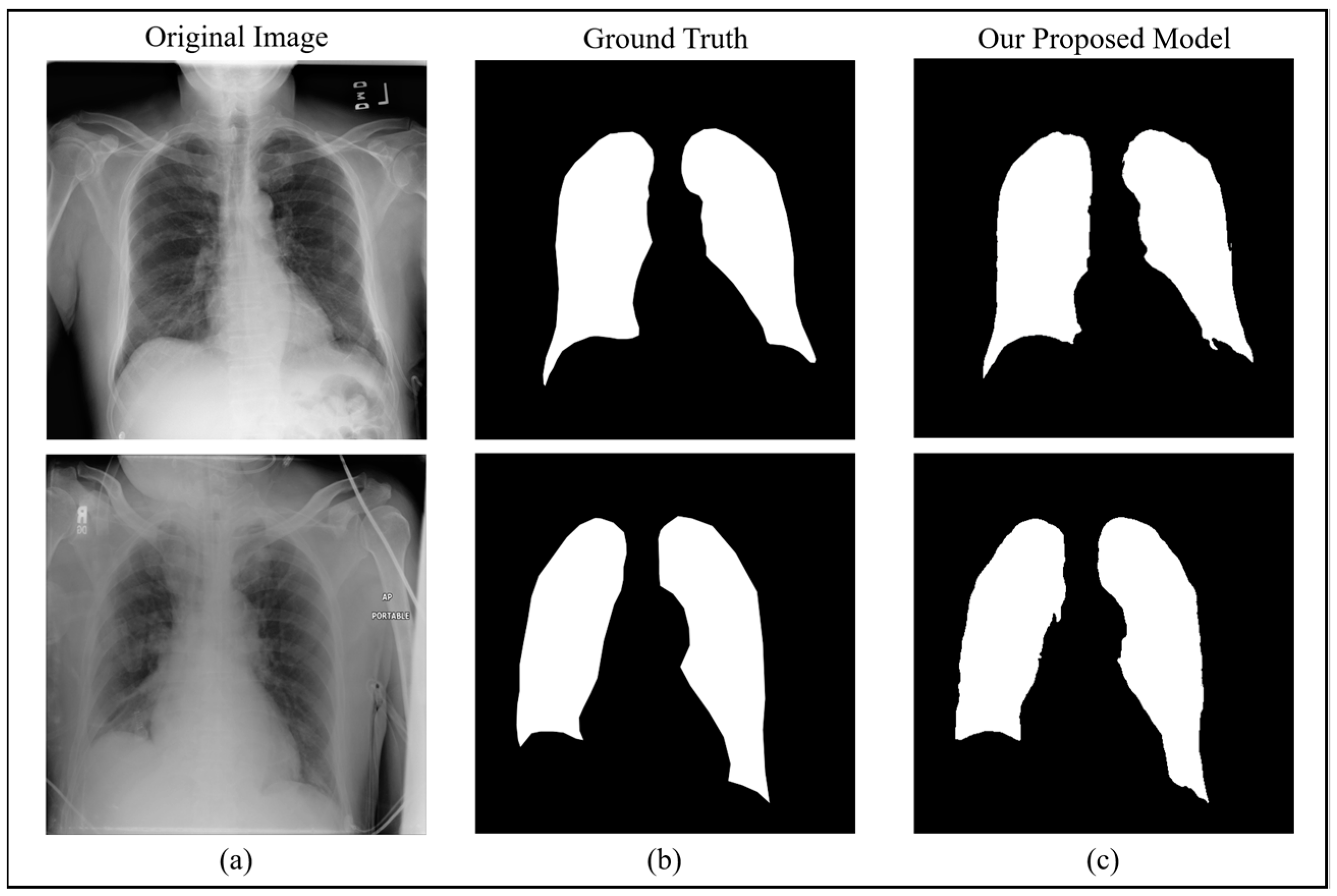 A Novel Fuzzy DBNet for Medical Image Segmentation