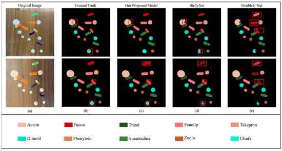 A Novel Fuzzy DBNet for Medical Image Segmentation