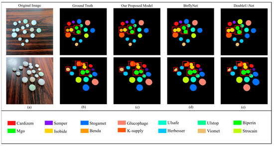A Novel Fuzzy DBNet for Medical Image Segmentation