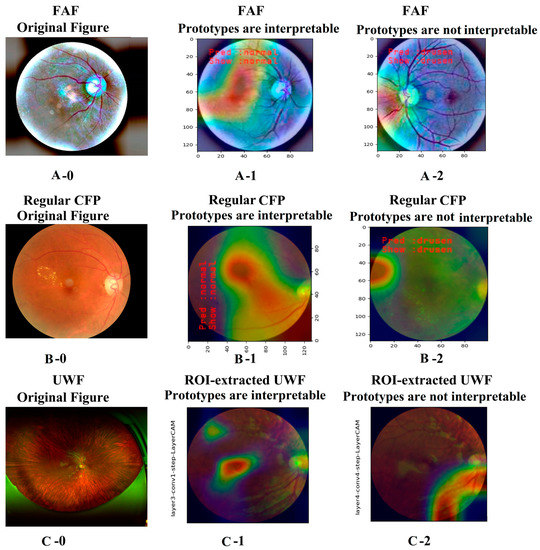 An Explainable Artificial Intelligence-Based Robustness Optimization Approach for Age-Related ...