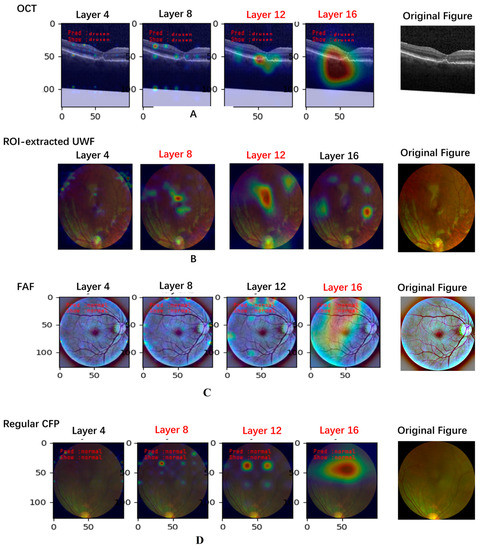 An Explainable Artificial Intelligence-Based Robustness Optimization Approach for Age-Related ...