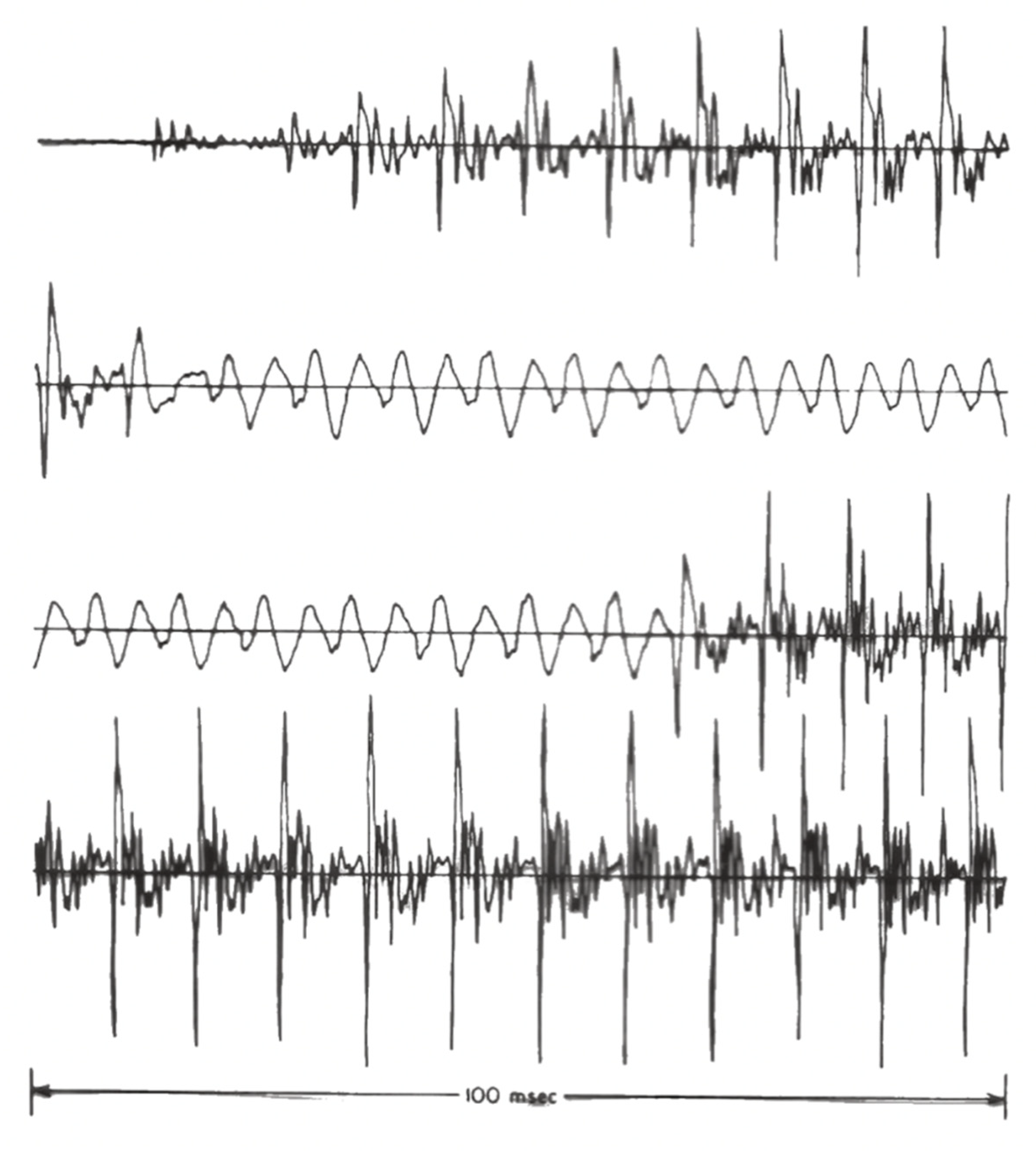 Review of Advances in Speech Processing with Focus on Artificial Neural ...