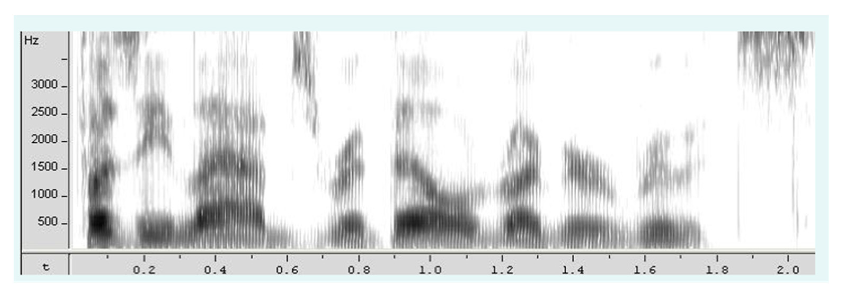 Review of Advances in Speech Processing with Focus on Artificial Neural ...