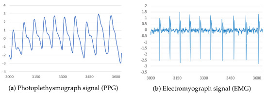 Physiological Signal-Based Real-Time Emotion Recognition Based on Exploiting Mutual Information ...