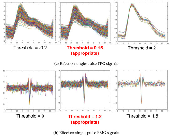 Physiological Signal-Based Real-Time Emotion Recognition Based on Exploiting Mutual Information ...