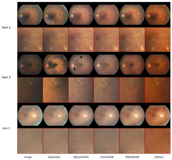 Electronics | Free Full-Text | An Unsupervised Fundus Image Enhancement Method with Multi-Scale ...