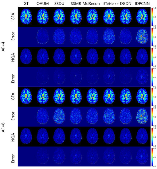 Order-Aware Uncertainty Minimization Network for Fast High Angular ...