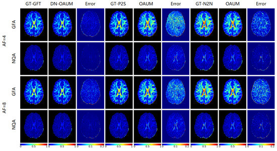 Order-Aware Uncertainty Minimization Network for Fast High Angular Resolution Diffusion Imaging ...