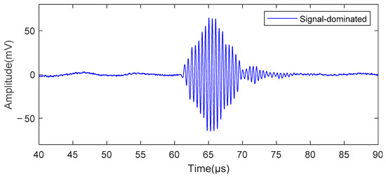 Wavelet Threshold Ultrasound Echo Signal Denoising Algorithm Based on ...