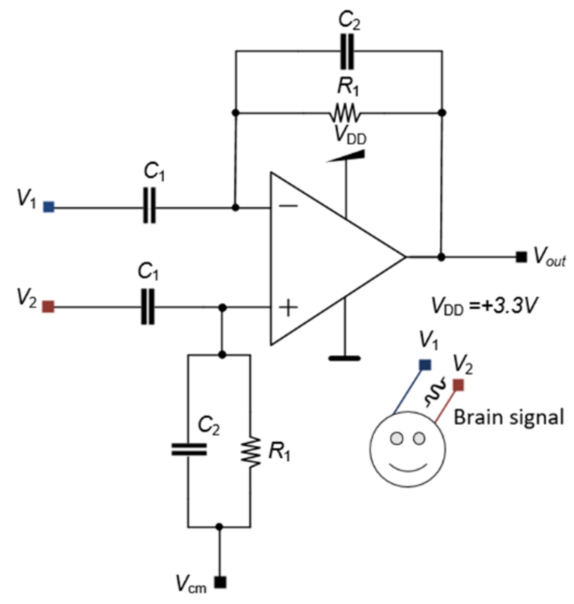 Electronics Free Full Text Wireless Device With Energy Management For Closed Loop Deep Brain 