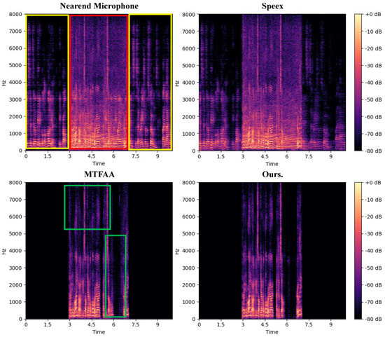 A Multi-Stage Acoustic Echo Cancellation Model Based on Adaptive ...