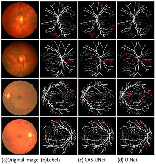 Electronics | Free Full-Text | CAS-UNet: A Retinal Segmentation Method Based on Attention
