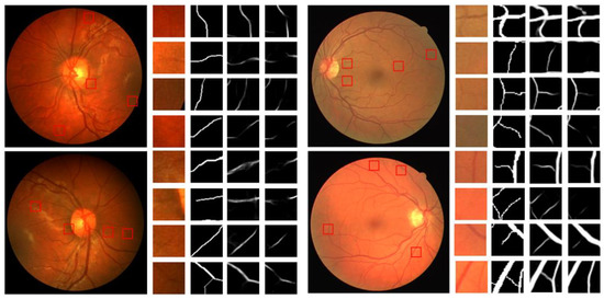 Electronics | Free Full-Text | CAS-UNet: A Retinal Segmentation Method Based on Attention