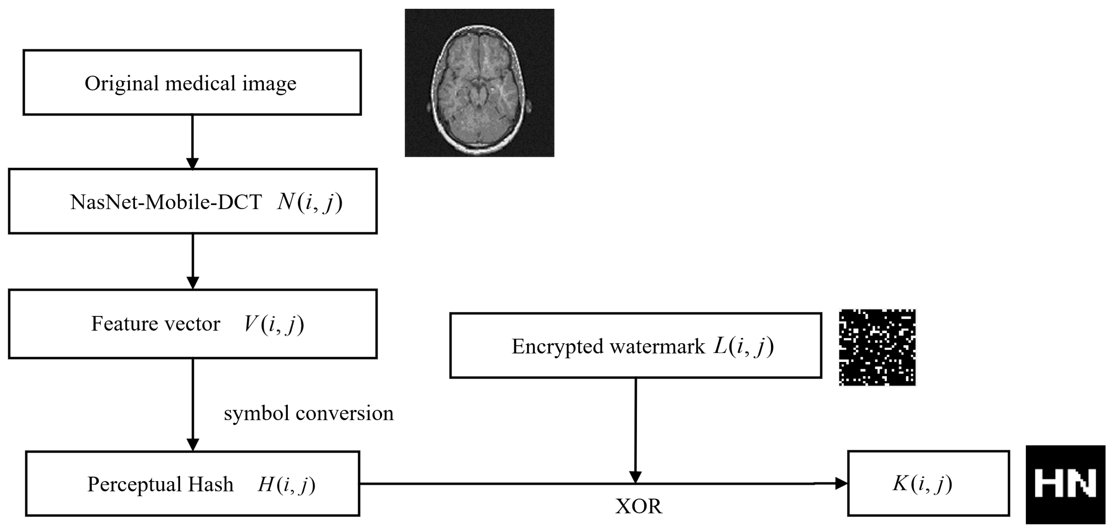 Robust Zero Watermarking Algorithm for Medical Images Based on Improved NasNet-Mobile and DCT
