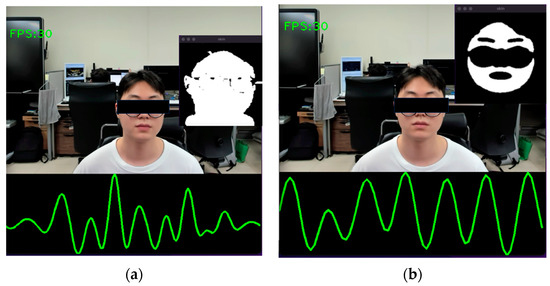 Electronics | Free Full-Text | Improving Remote Photoplethysmography ...