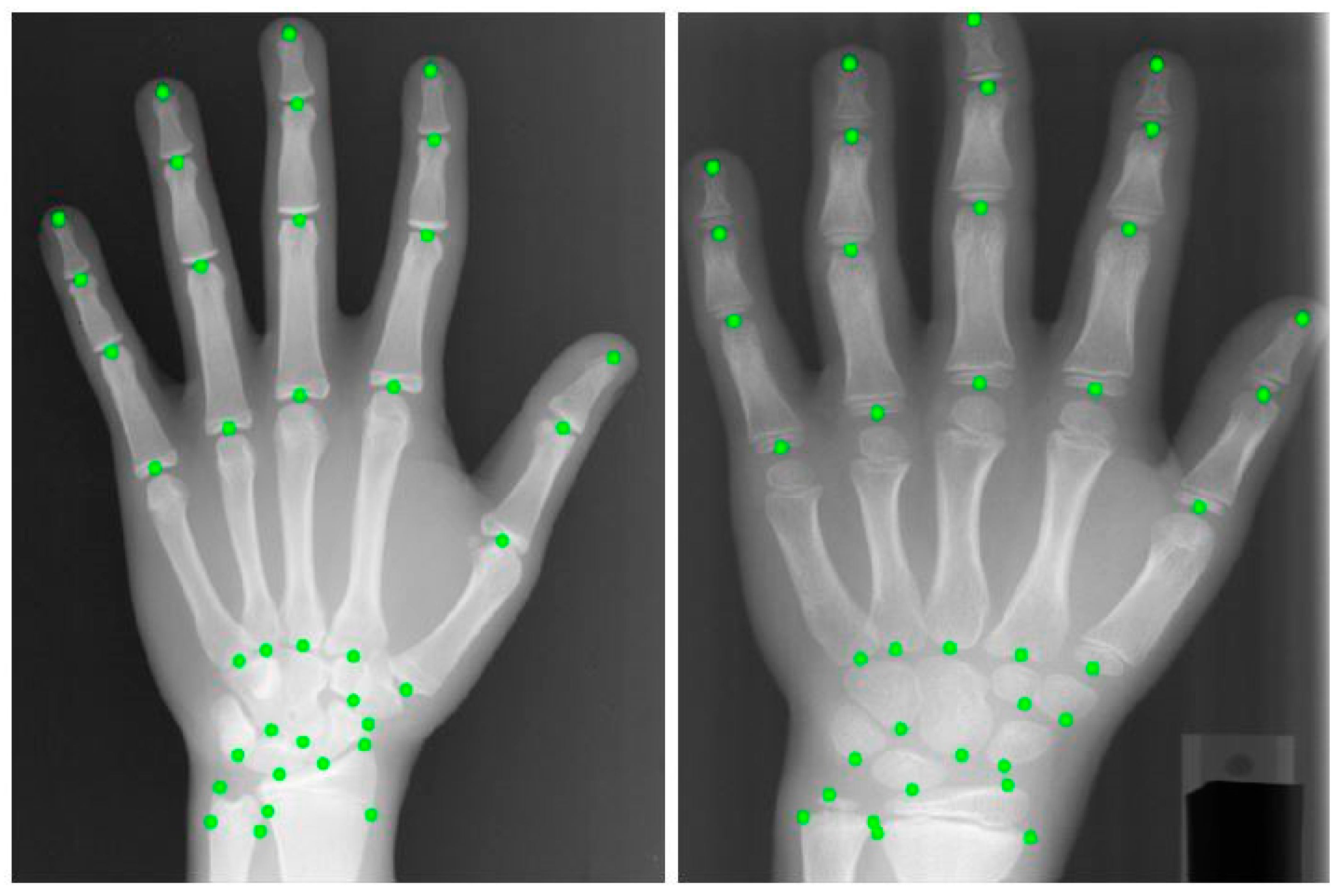 Electronics | Free Full-Text | Learning Spatial Configuration Feature ...