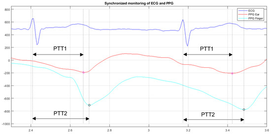 ecoSync: An Energy-Efficient Clock Discipline Data Synchronization in ...
