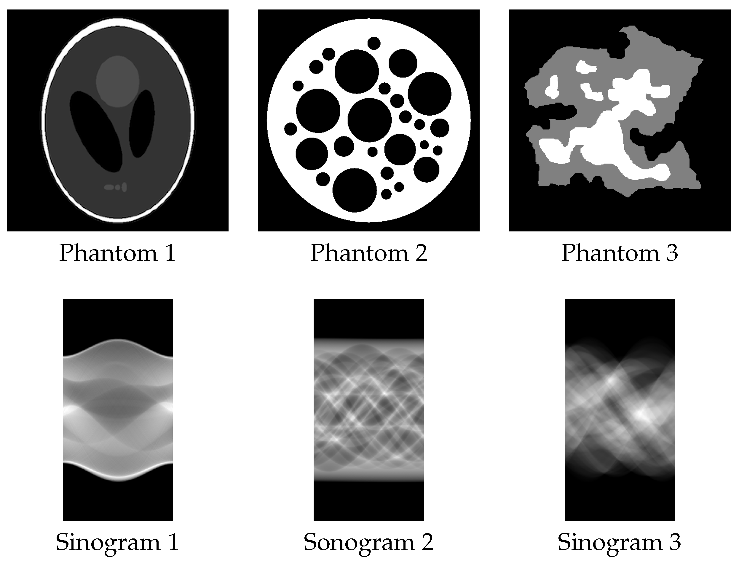 Electronics | Free Full-Text | Sinogram Upsampling via Sub-Riemannian Diffusion with Adaptive ...