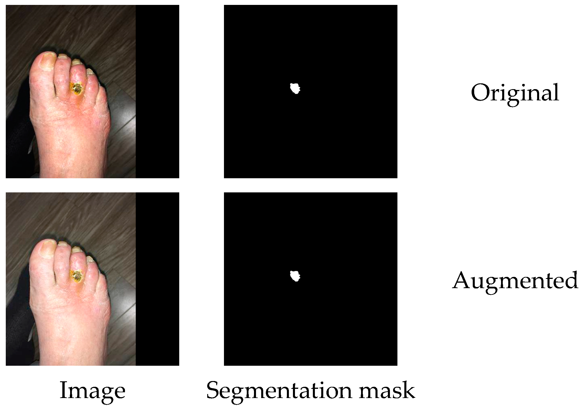 Electronics | Free Full-Text | Analysis of Training Data Augmentation for Diabetic Foot Ulcer ...