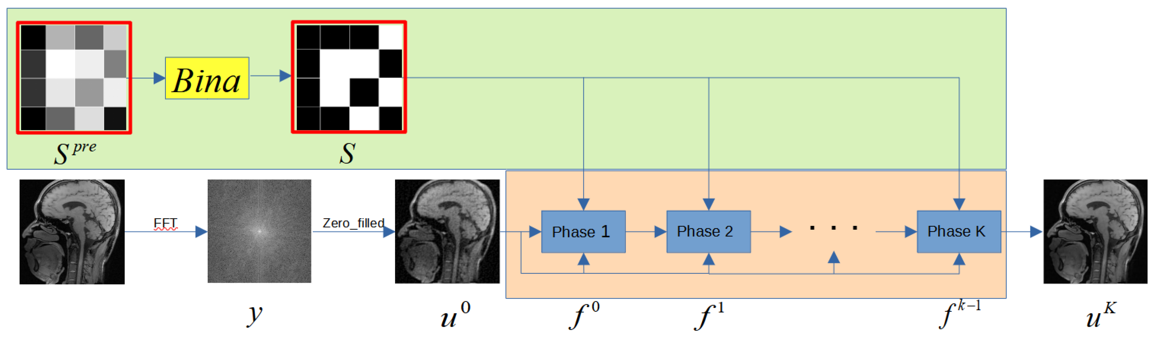 Learing Sampling and Reconstruction Using Bregman Iteration for CS-MRI