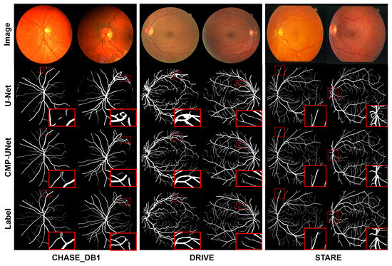 Electronics | Free Full-Text | CMP-UNet: A Retinal Vessel Segmentation Network Based on Multi ...