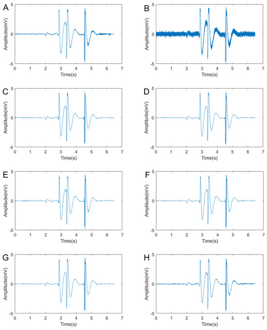 Research on the Signal Noise Reduction Method of Fish ...