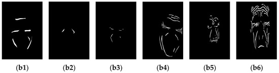 Electronics | Free Full-Text | Facial Wrinkle Detection with Multiscale Spatial Feature Fusion ...