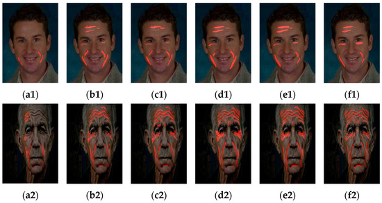Electronics | Free Full-Text | Facial Wrinkle Detection with Multiscale Spatial Feature Fusion ...
