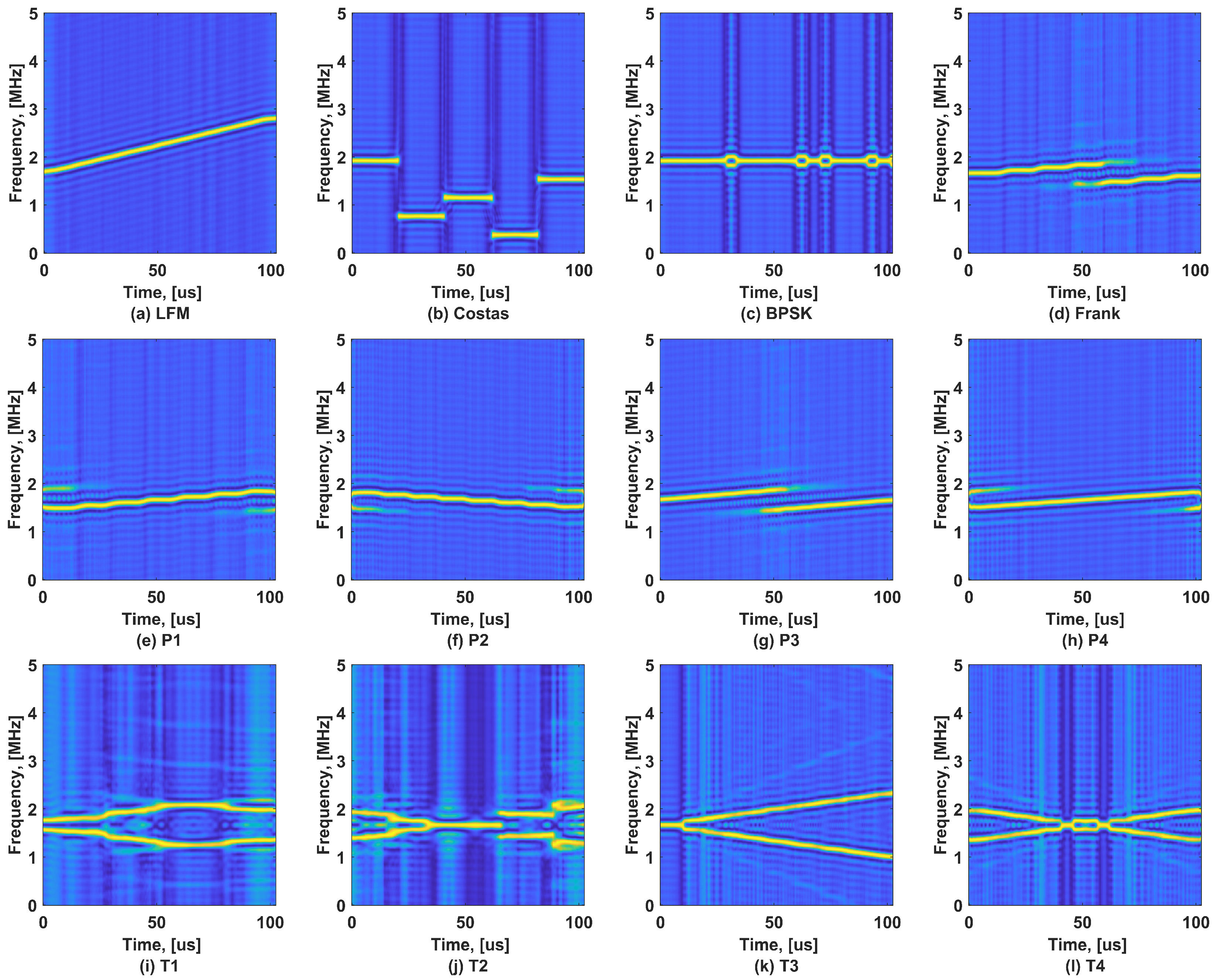 Electronics | Free Full-Text | LPI Radar Signal Recognition Based on Feature Enhancement with ...