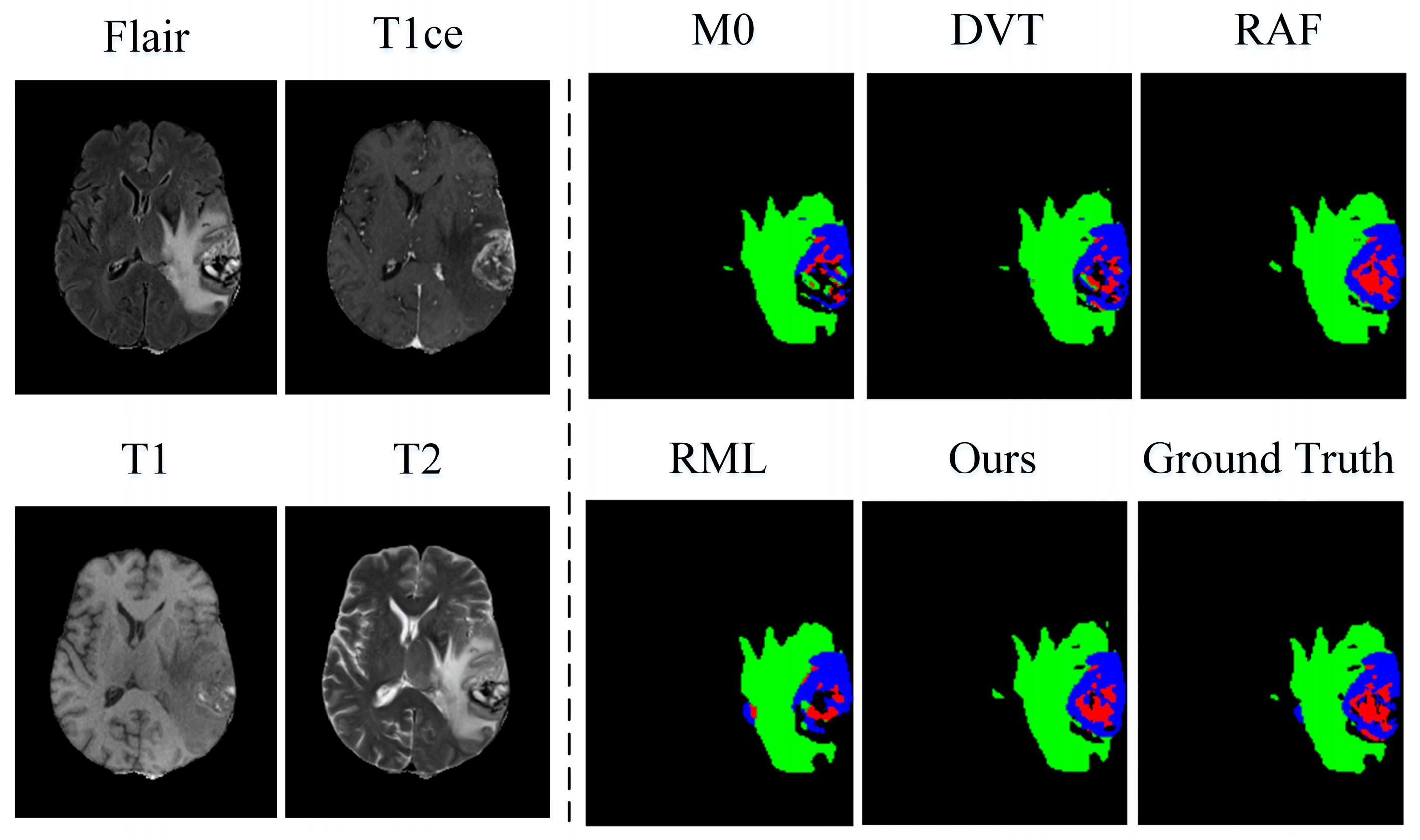 Electronics | Free Full-Text | RFTNet: Region–Attention Fusion Network Combined with Dual-Branch ...