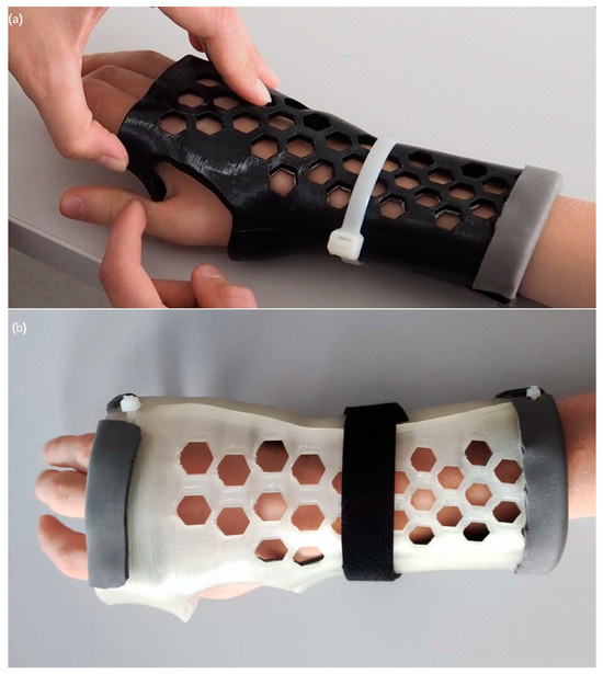 Electronics | Free Full-Text | Development and Studies of VR-Assisted ...