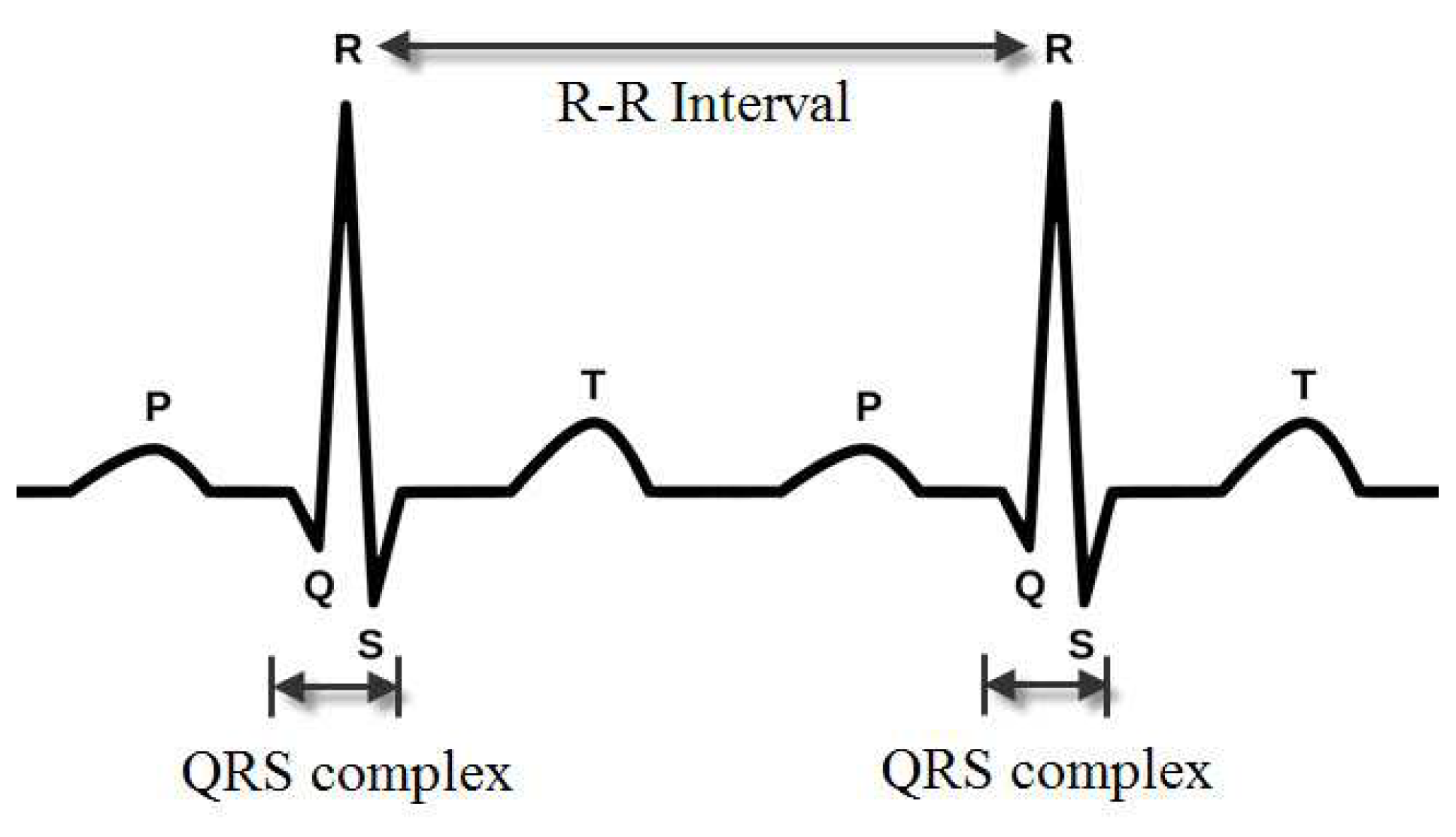 Healthcare Big Data Analysis with Artificial Neural Network for Cardiac ...