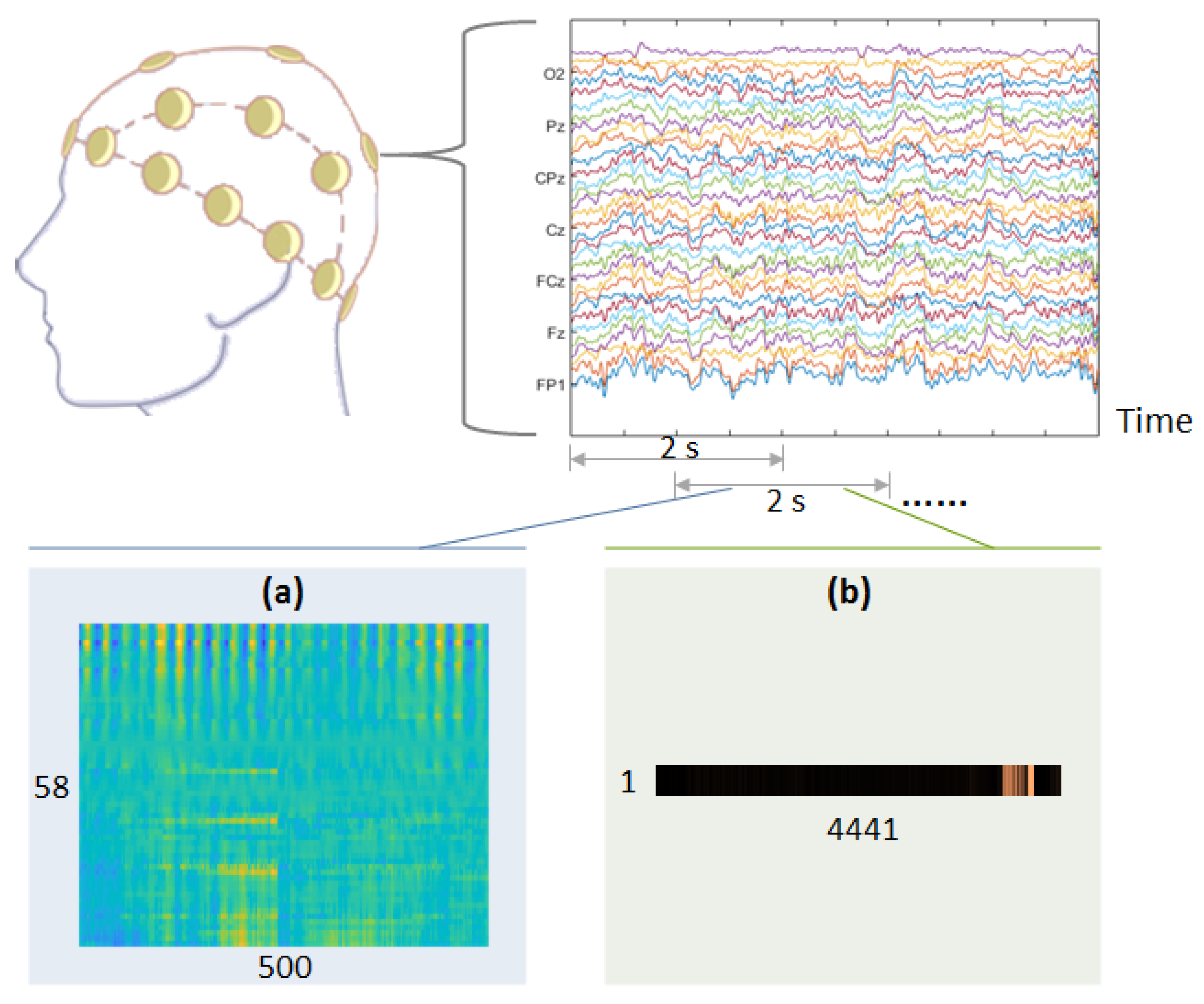 Effects of the Hyperparameters on CNNs for MDD Classification Using Resting-State EEG