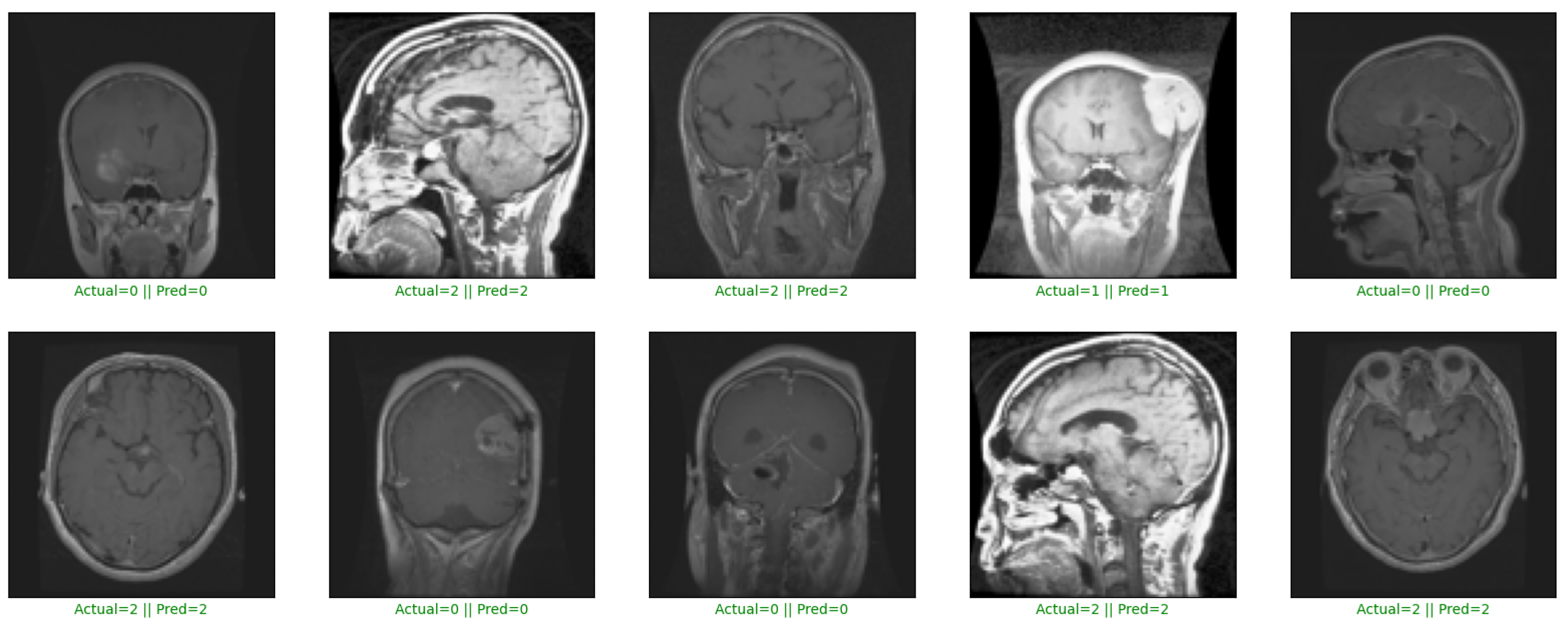 Electronics | Free Full-Text | A Convolutional Block Base Architecture for Multiclass Brain ...