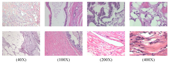 Multi-Branch Spectral Channel Attention Network for Breast Cancer ...
