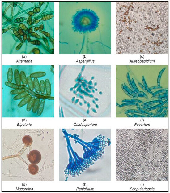 Multi-Convolutional Neural Network-Based Diagnostic Software for the ...