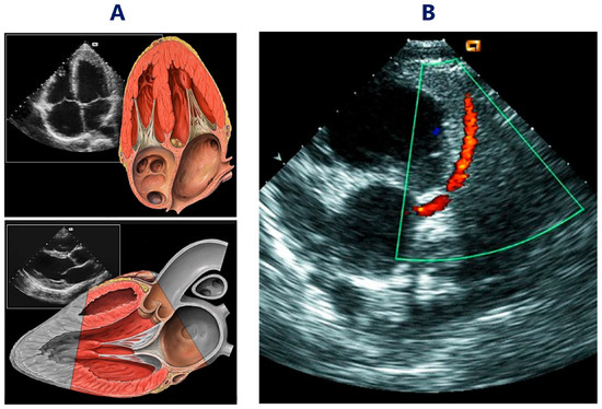 Electronics | Free Full-Text | Evaluation of Human Perception ...