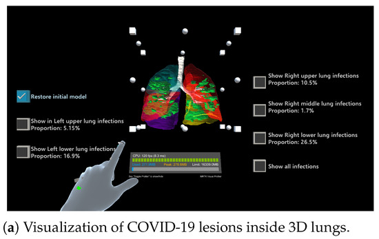 Augmented Reality Visualization and Quantification of COVID-19 ...