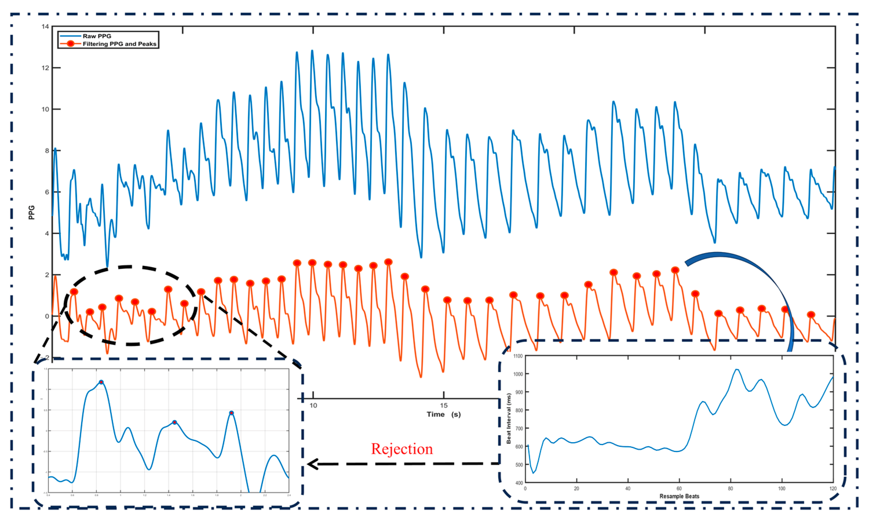 Assessment of Mental Workload Level Based on PPG Signal Fusion ...