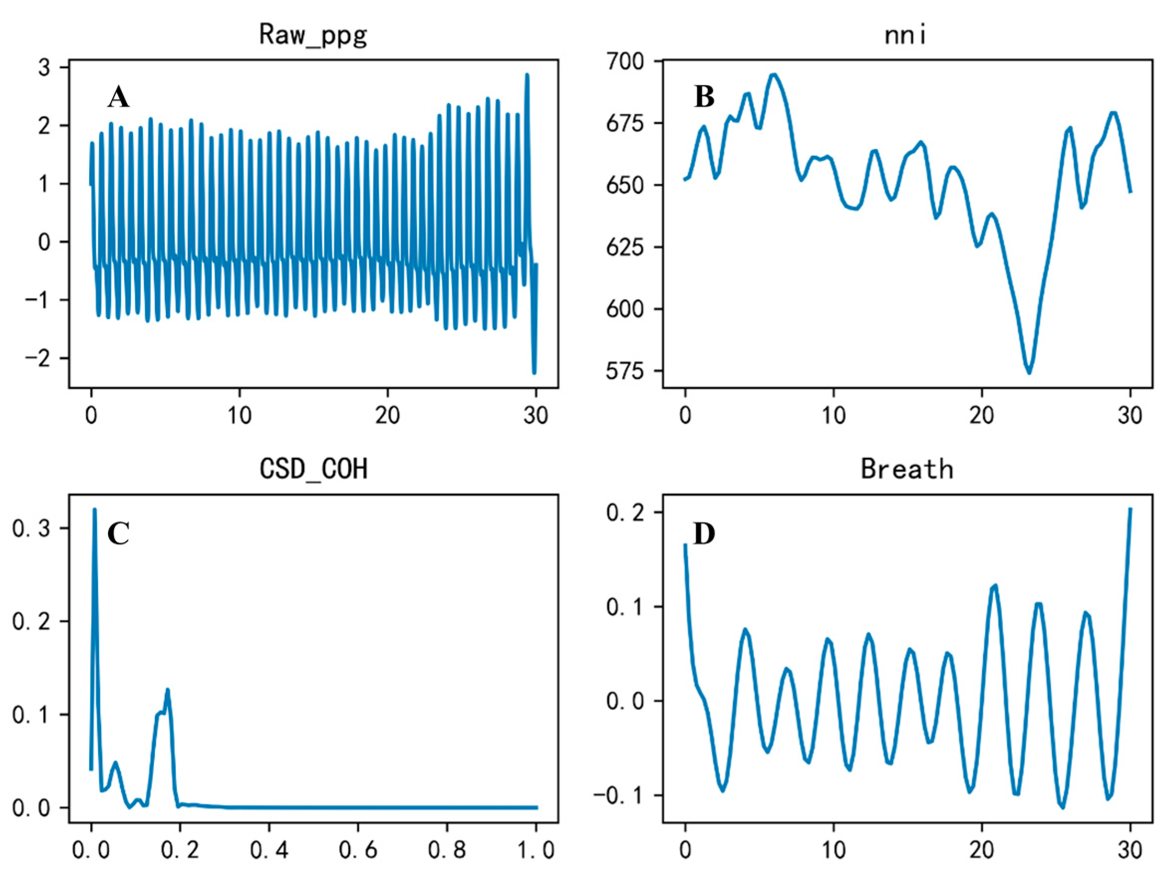 Assessment of Mental Workload Level Based on PPG Signal Fusion ...
