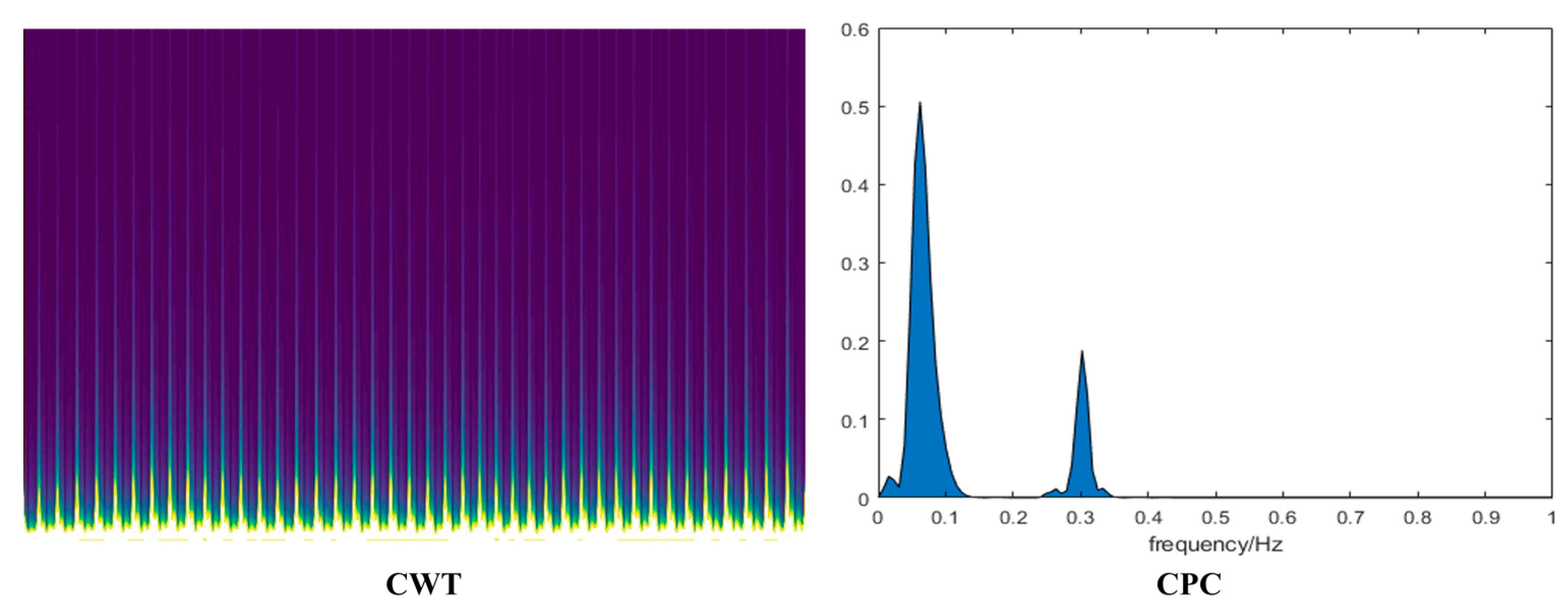 Assessment of Mental Workload Level Based on PPG Signal Fusion ...