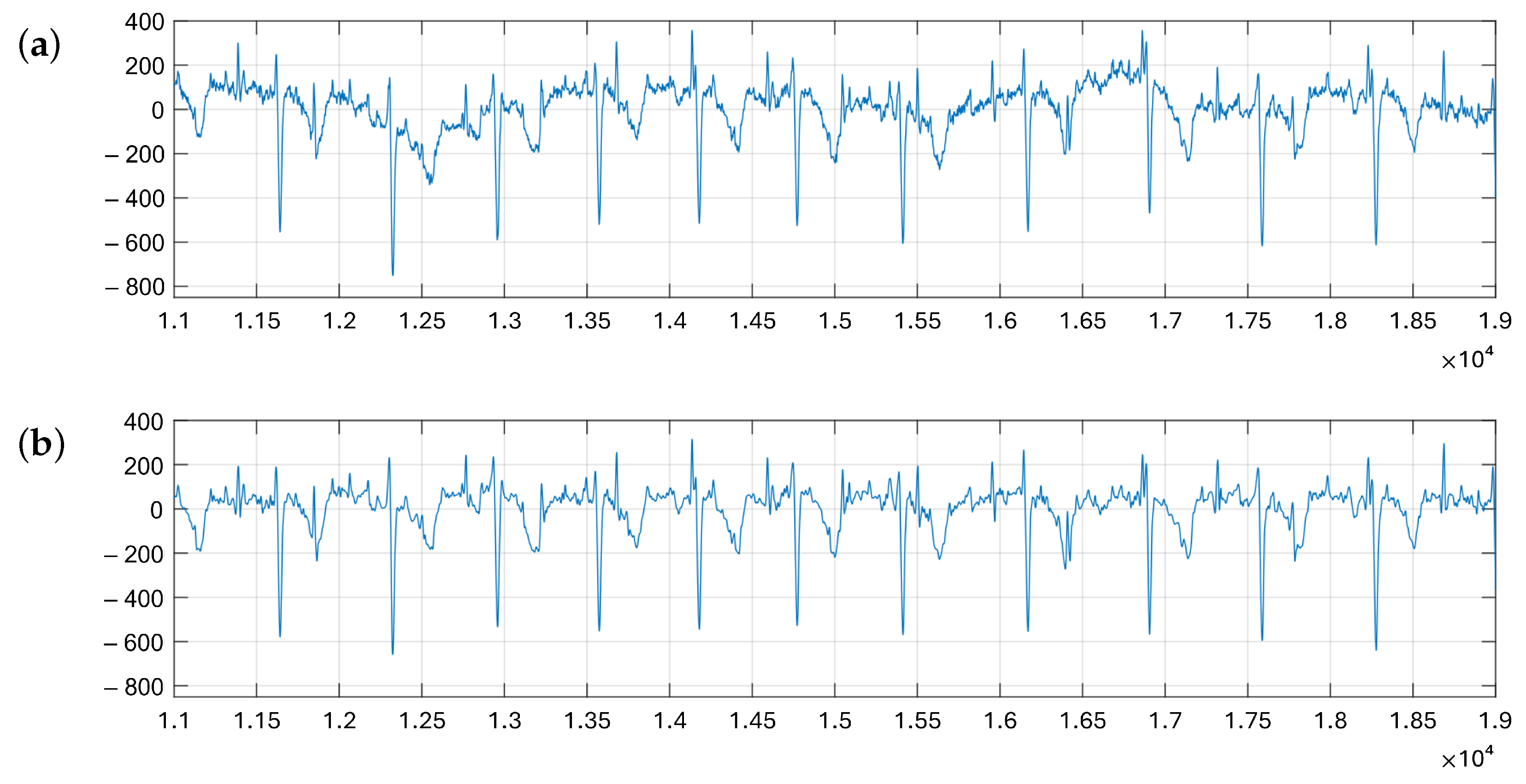 PCA-Based Preprocessing for Clustering-Based Fetal Heart Rate ...