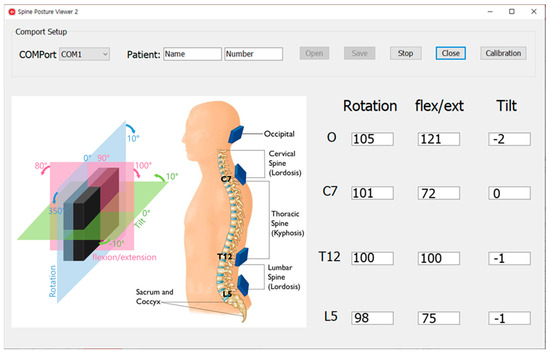 Electronics | Free Full-Text | Comparison of Neck Pain and Posture with ...