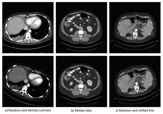 Electronics | Free Full-Text | Robustness Assessment of AI-Based 2D ...
