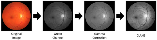 Enhanced Vascular Bifurcations Mapping: Refining Fundus Image Registration
