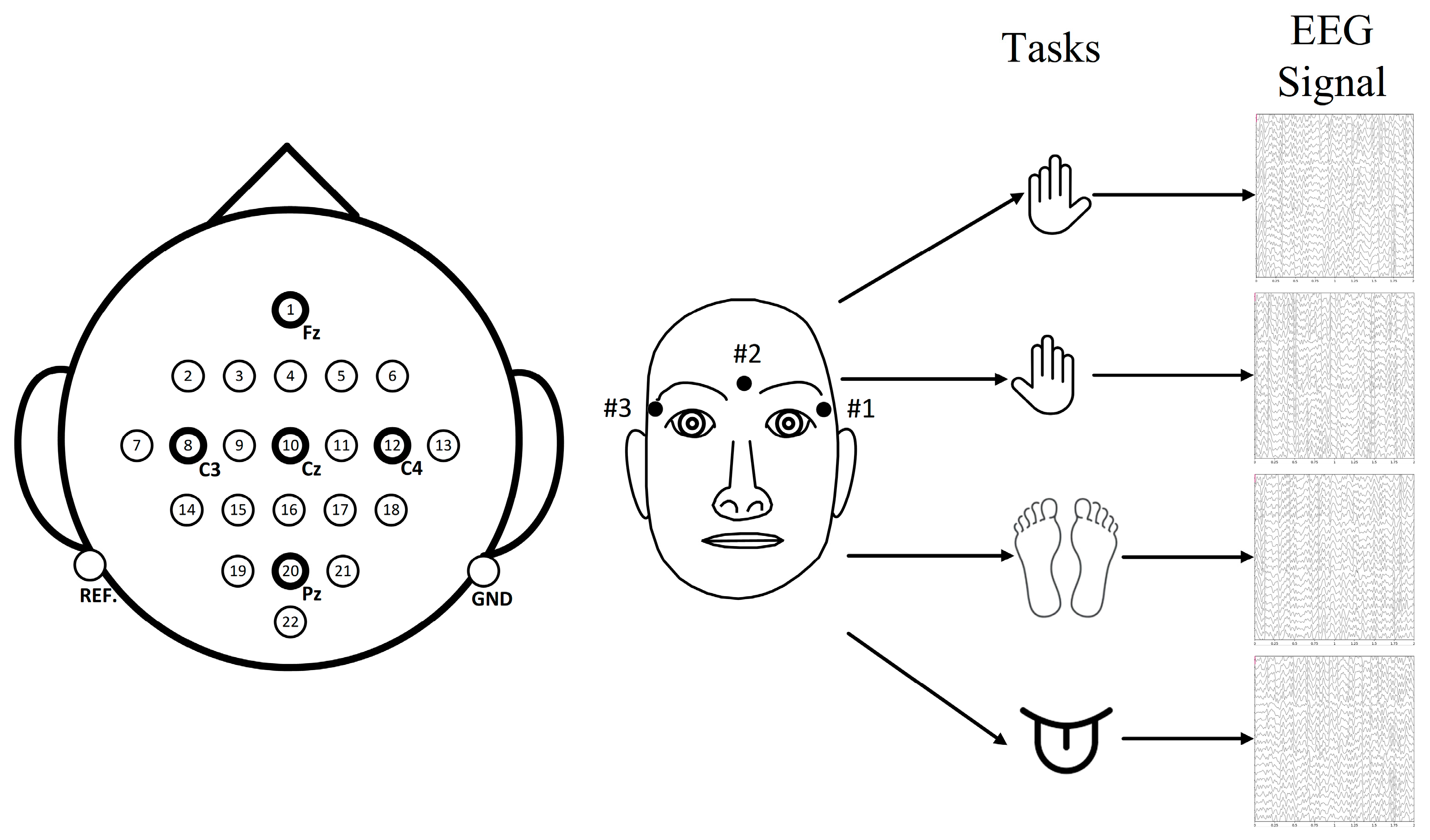 MST-DGCN: A Multi-Scale Spatio-Temporal and Dynamic Graph Convolution Fusion Network for ...