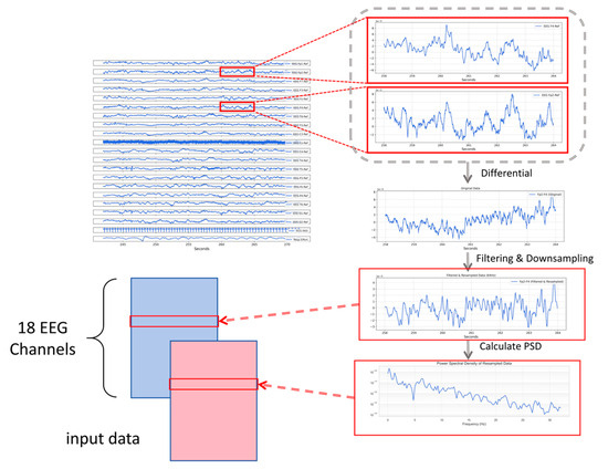 LMA-EEGNet: A Lightweight Multi-Attention Network for Neonatal Seizure Detection Using EEG signals
